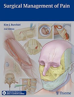 Surgical Management of Pain by : English E-Book | Ex Libris